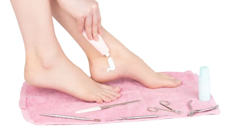 What Causes Calluses on the Foot? | Lapiden